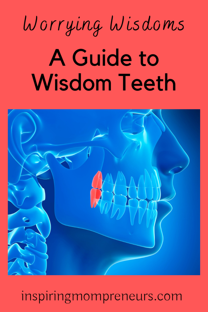 Worrying Wisdoms | A Handy Guide to Wisdom Teeth